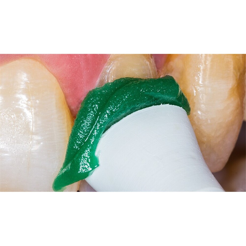 DMG Flairesse Prophy Paste - Mint - Coarse - 1.8g Single Doses, 200 ...