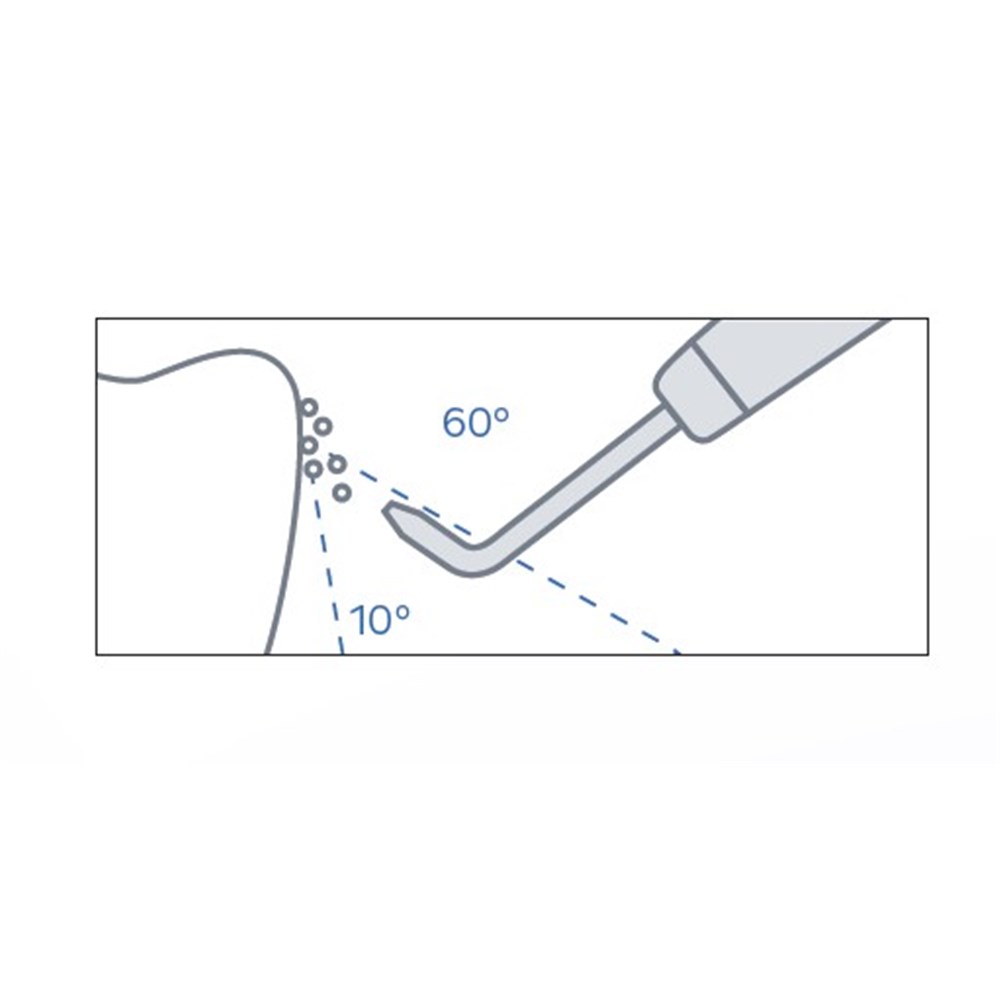 KaVo PROPHYpearls - Supragingival Cleaning Powder - 15g, 80-Pack ...