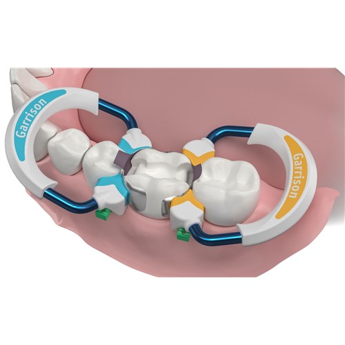 Garrison Strata-G Sectional Matrix System - Intro Kit | Bands - Henry ...