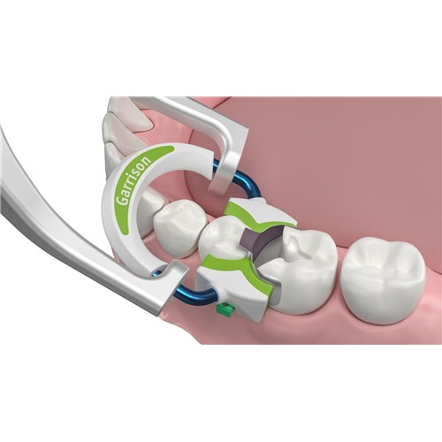 Garrison Strata-G Sectional Matrix System - Basic Kit | Bands - Henry ...