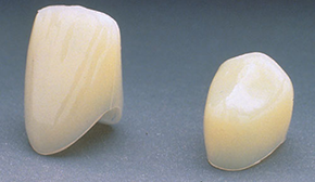 Crown Forms - Crown & Bridge - Henry Schein Australian dental products ...